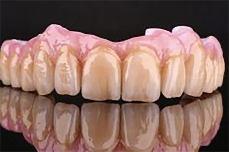 Prettau Zirkonia - Intellident